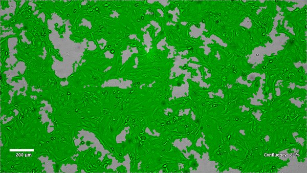 LX-2 Cas9 Human Hepatic Stellate Cell Line | SCC613